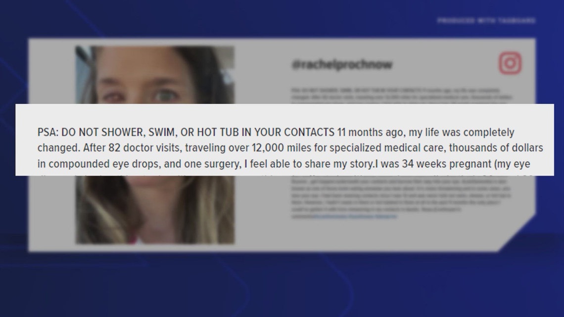 Texas influencer Rachel Prochnow has warning for contact wearers | wltx.com