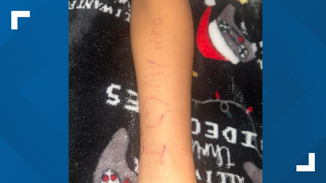 Students at Travis Intermediate in Greenville used same needle for ...