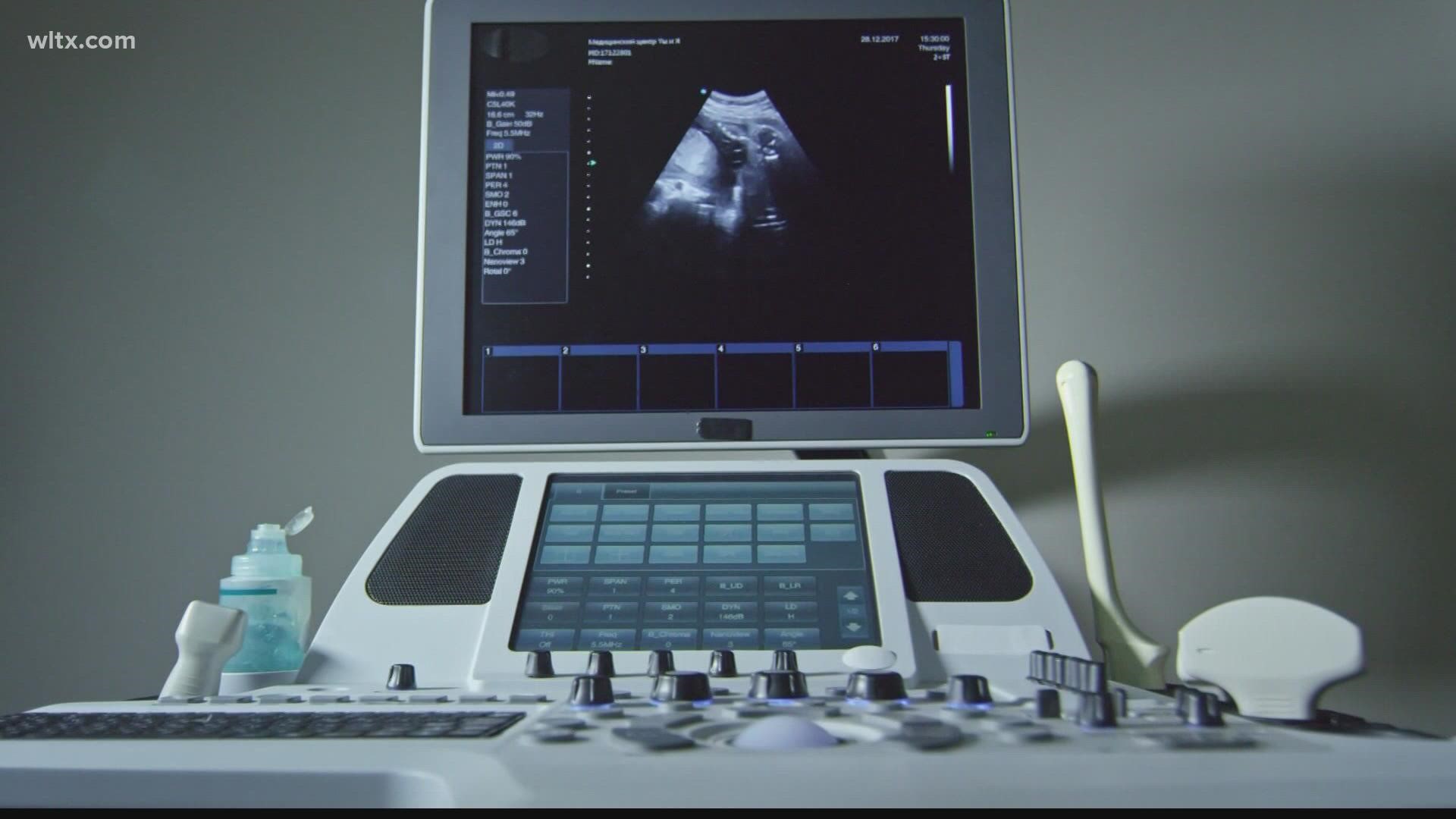 Bob Shields, longtime WLTX Sports Director, passes away | wltx.com