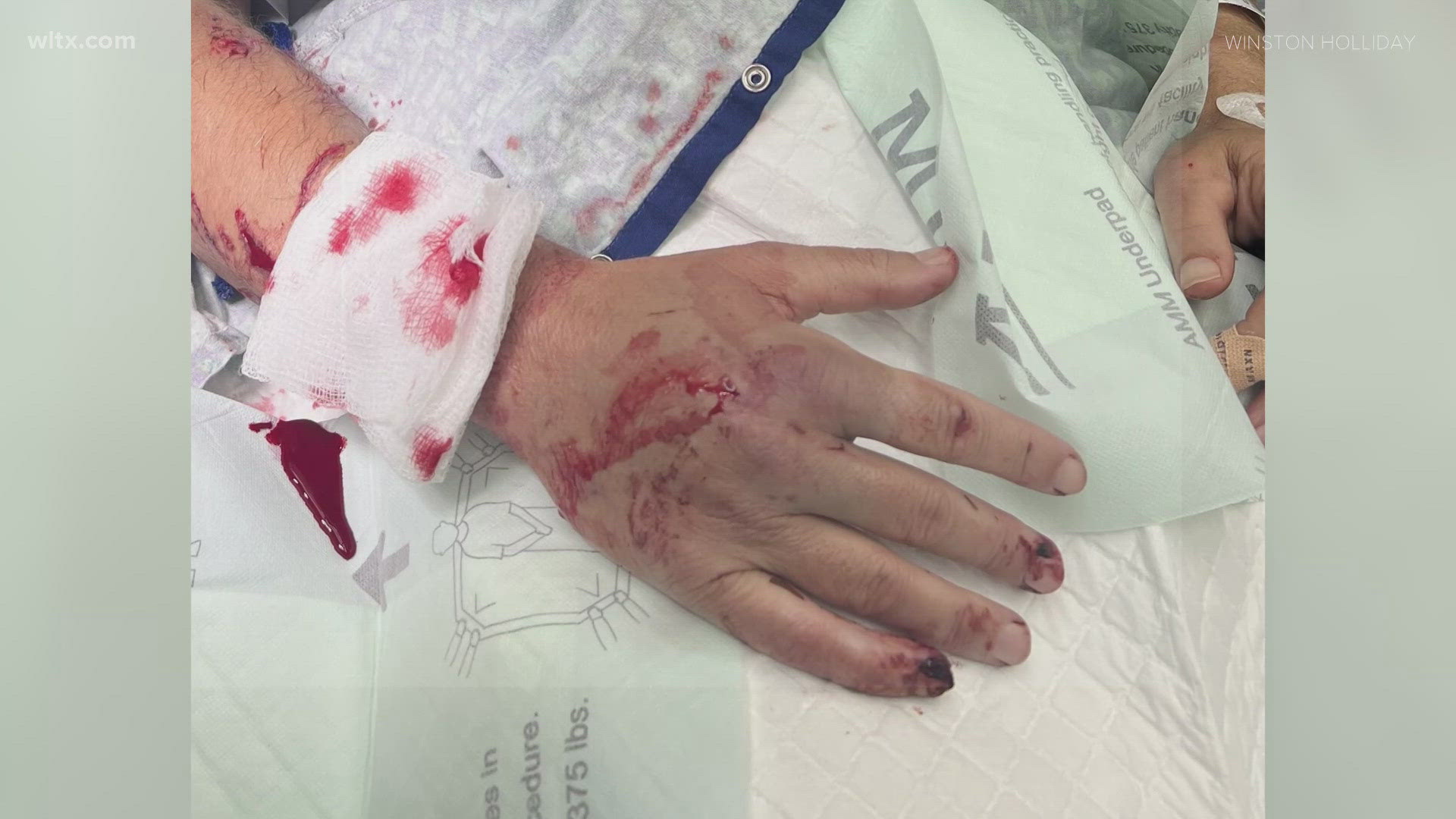 Harbison State Forest remains closed after dog attacks | wltx.com