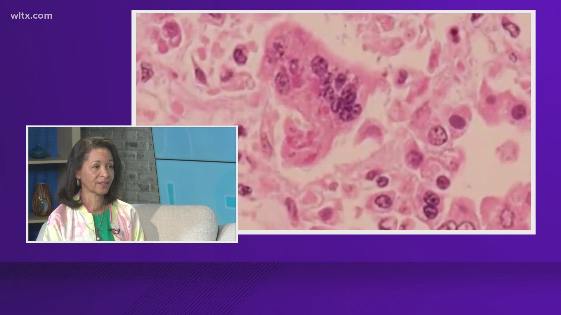 Health officials confirm first case of measles in SC | wltx.com