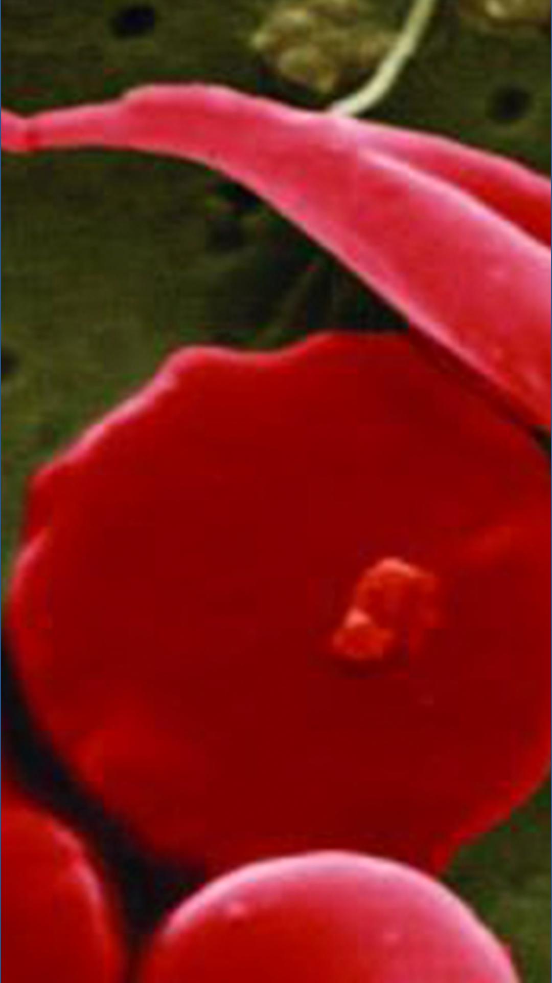 South Carolina DPH highlights sickle cell registry during awareness ...