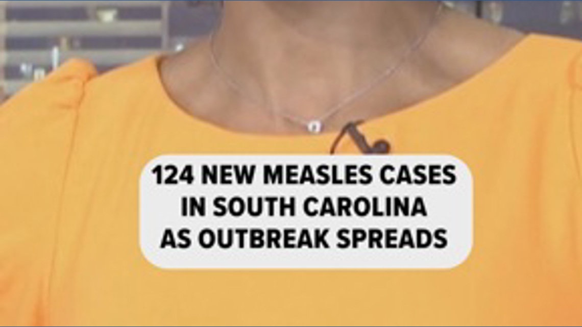 Measles cases spike again in South Carolina outbreak | wltx.com