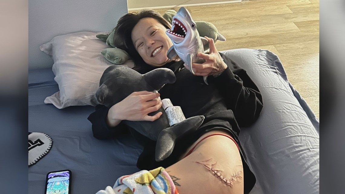 Florida woman says she's lucky to be alive after shark attack | wltx.com
