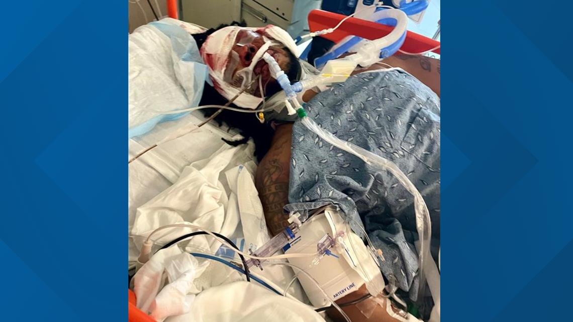 Army veteran Shamar Allen critically injured in I-75 Stockbridge hit ...