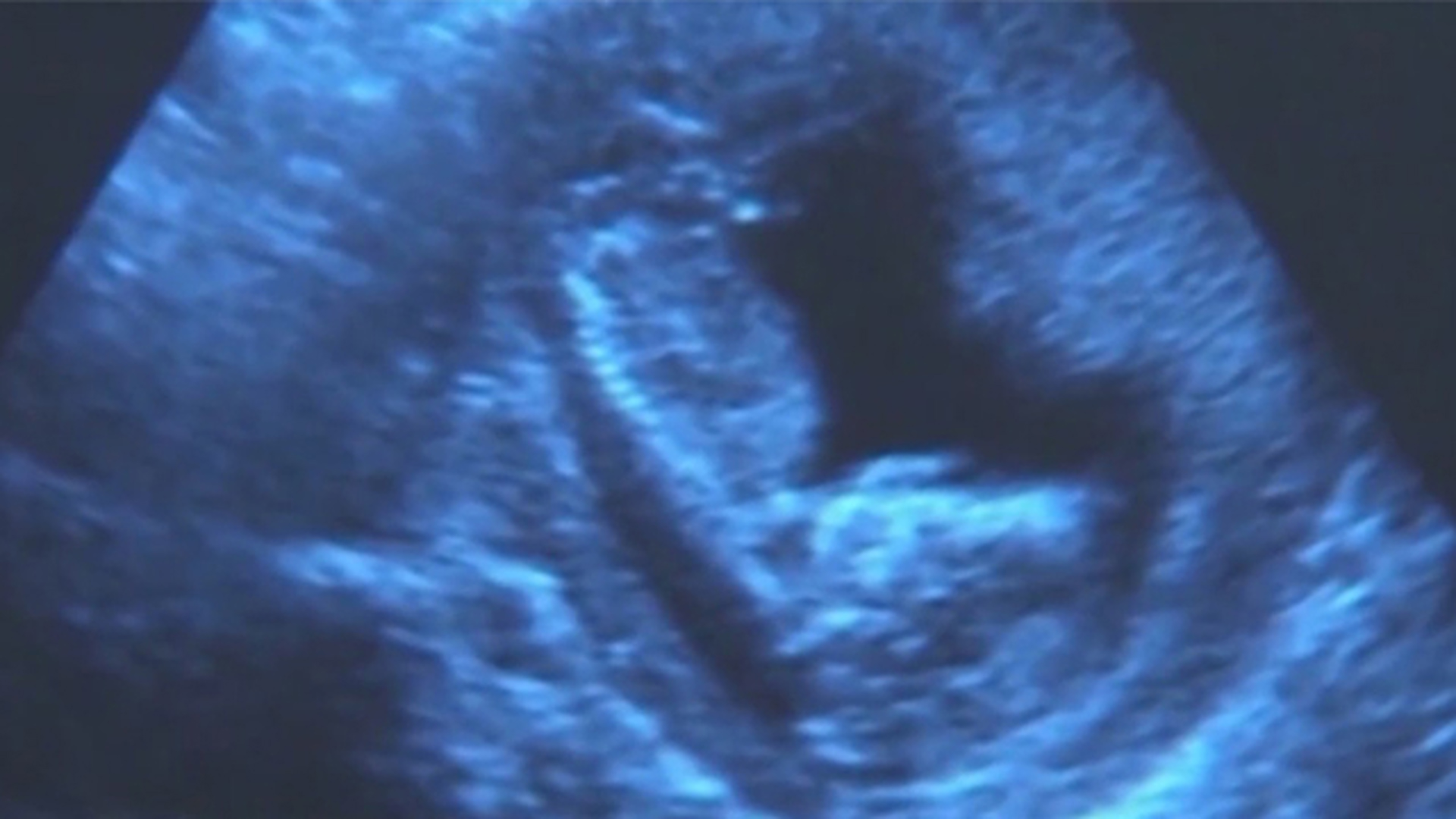 Measure to impose harsh abortion restrictions fails in SC Senate ...